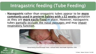 Feeding tube dr ravari | PDF