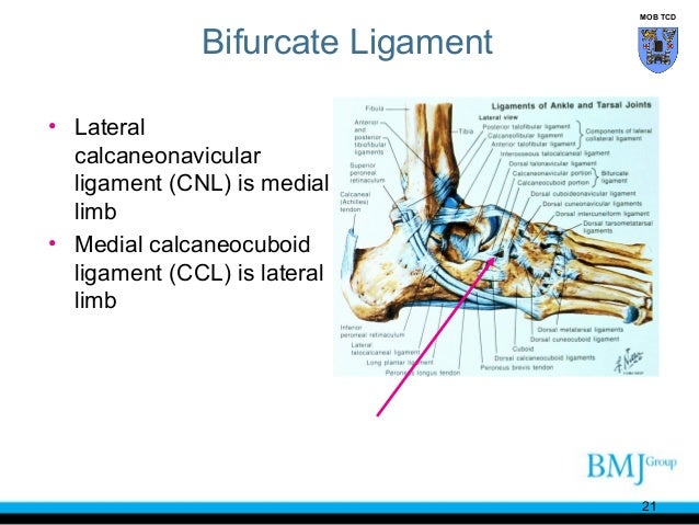 Bifurcate Ligament