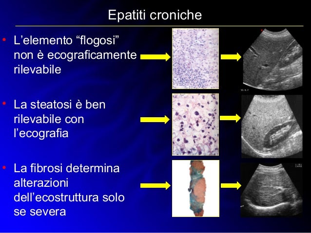 Pompili M. Fegato (Anatomia e Patologia Diffusa) Colecisti e Vie Bili…