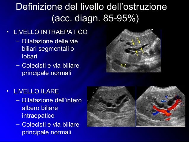 Pompili M. Fegato (Anatomia e Patologia Diffusa) Colecisti e Vie Bili…