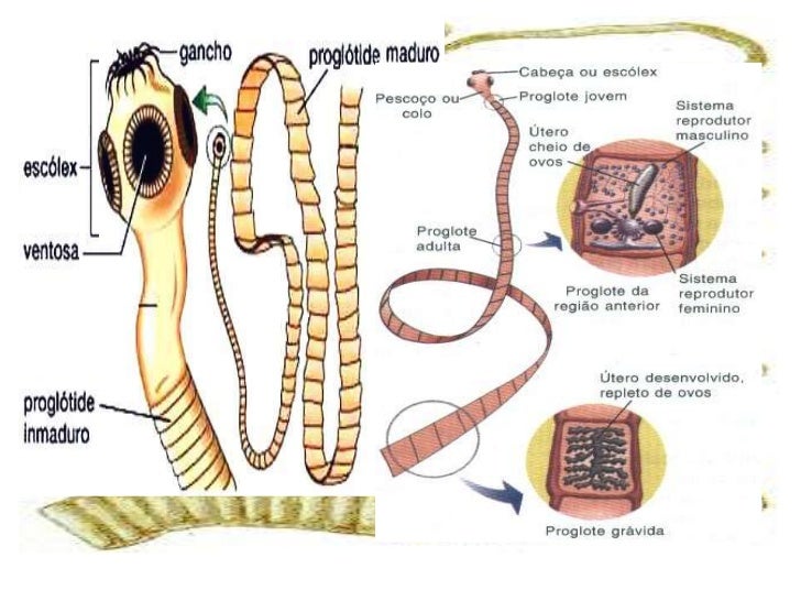 PLATELMINTOS (TÊNIA SOLIUM E SAGINATA)