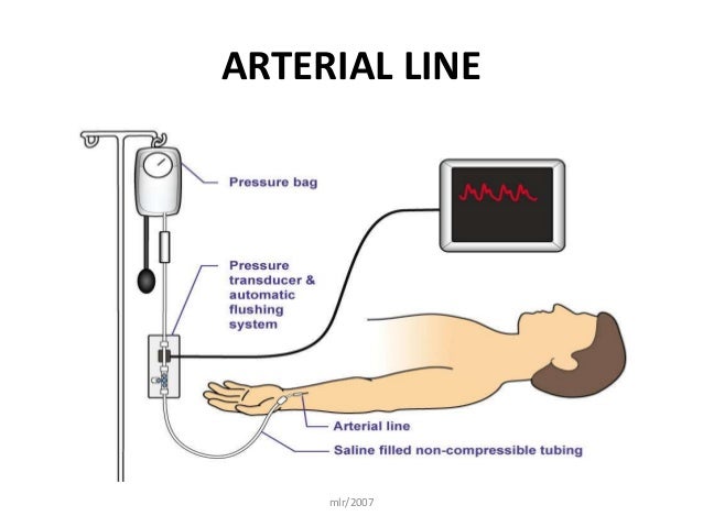 REVIEW OF HEMODYNAMIC MONITORING