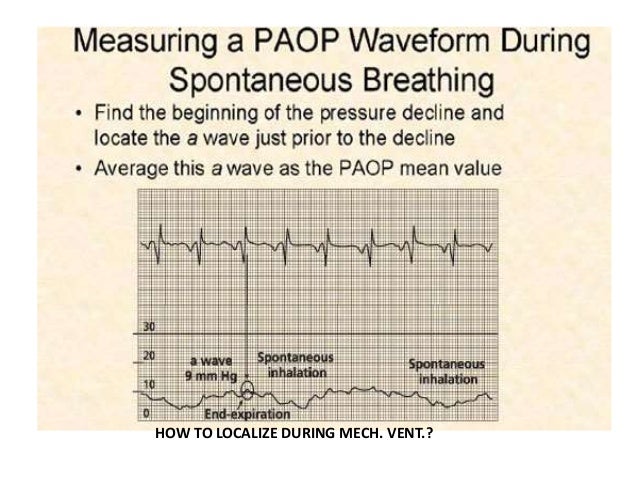 REVIEW OF HEMODYNAMIC MONITORING