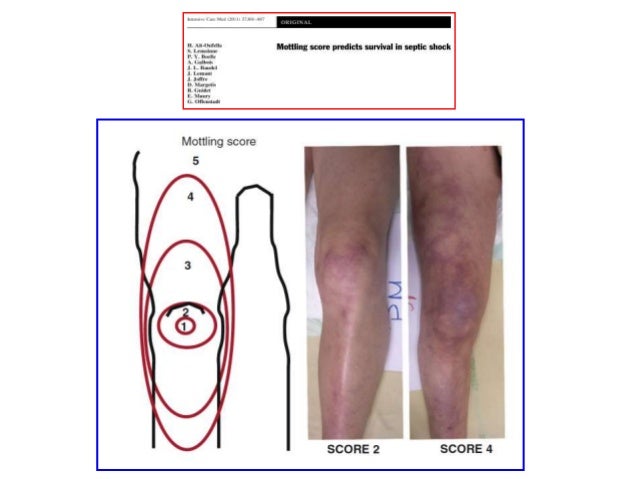 REVIEW OF HEMODYNAMIC MONITORING