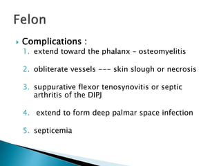 How Do You Treat A Felony Infection