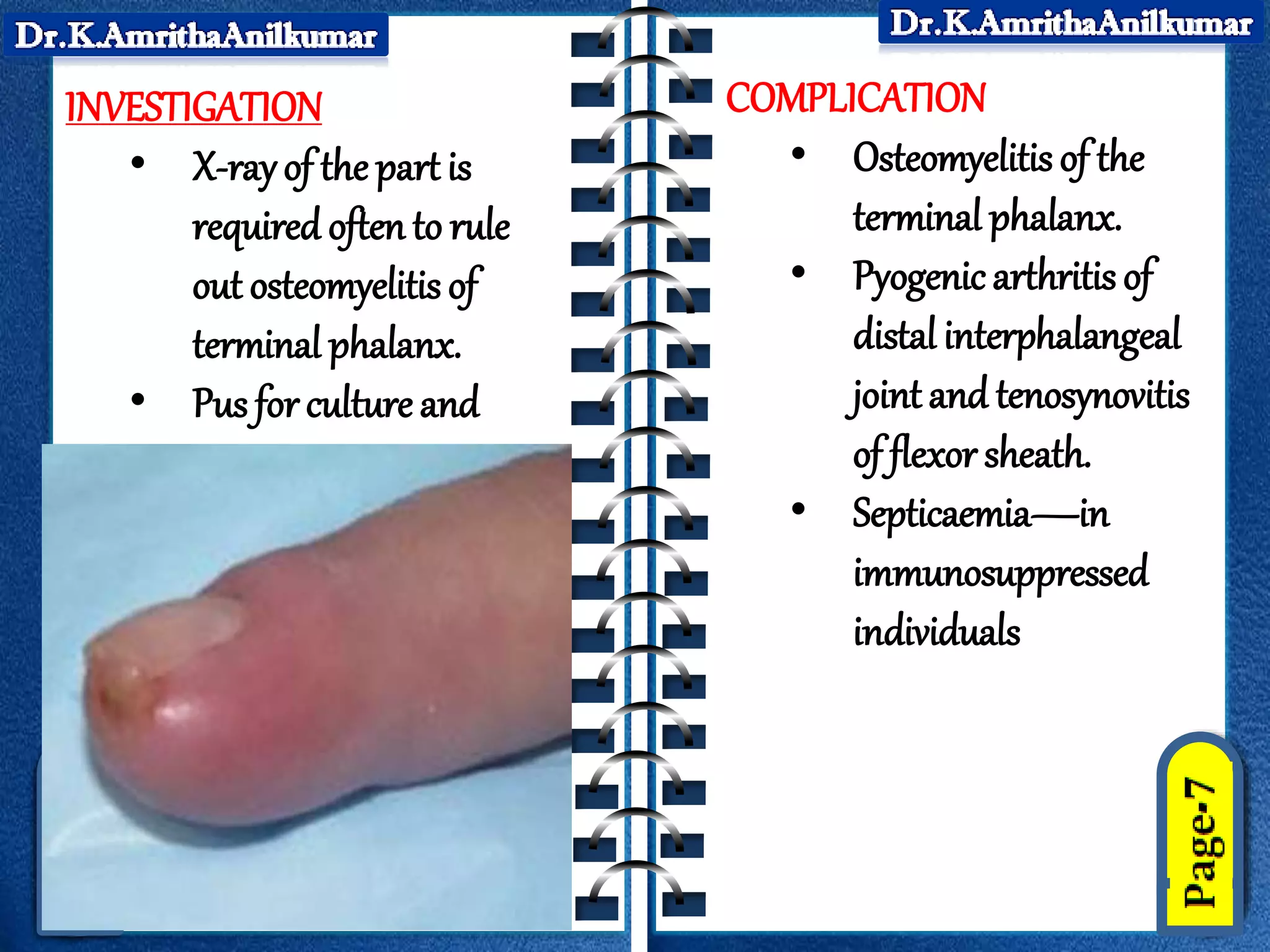 Felon or Terminal pulp infection by Dr.K.AmrithaAnilkumar | PPT