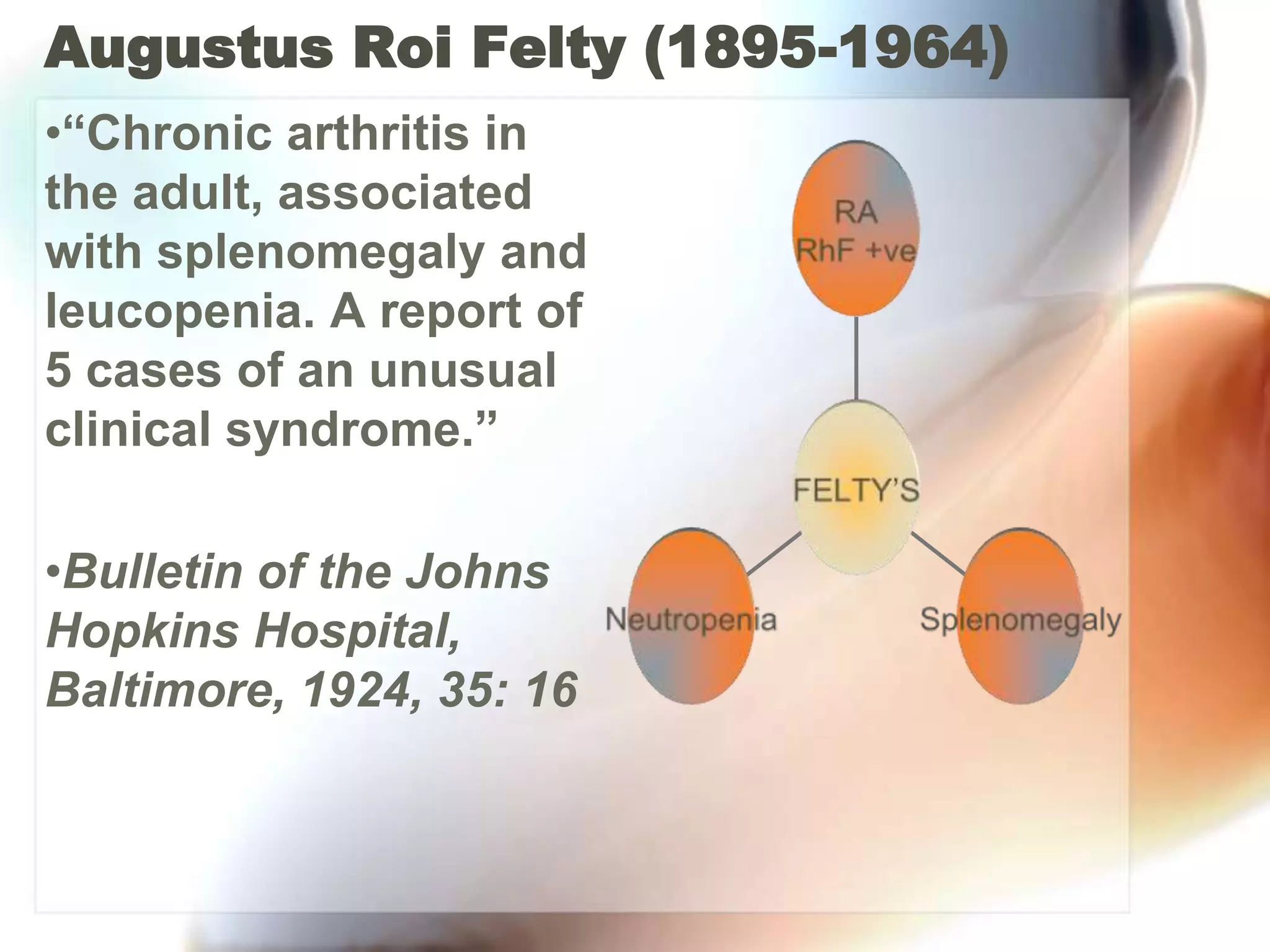Felty's syndrome | PPTX