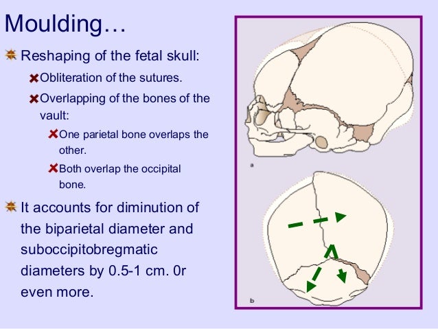 Female bony pelvis and fetal skull for undergraduate