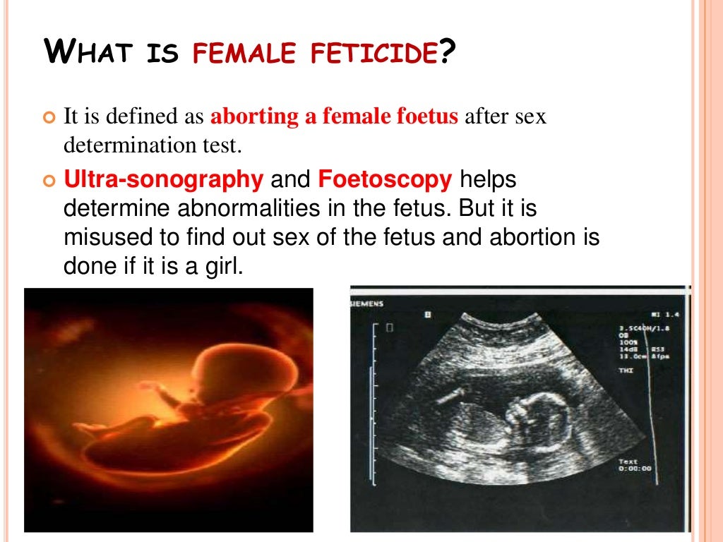Female Foeticide in India