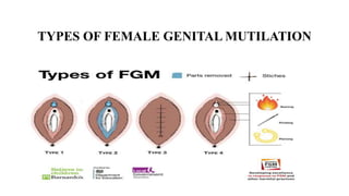 INTRODUCTION TO FEMALE GENITAL MUTILATION.pptx | Sexual Health ...