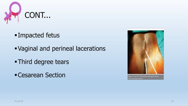 FEMALE GENITAL MUTILATION (FGM).pptx | Pregnancy | Reproductive Health