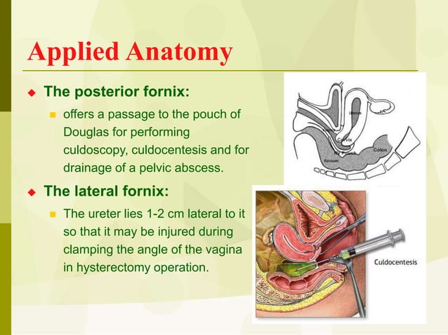 FEMALE GENITAL SYSTEM ANAT.ppt