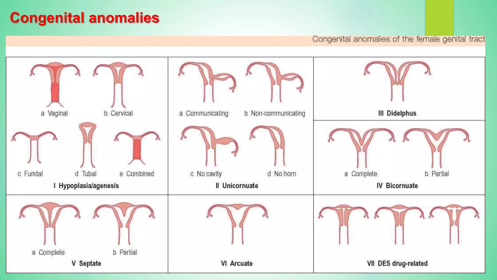 Female genital system anatomy & embryology | PPTX