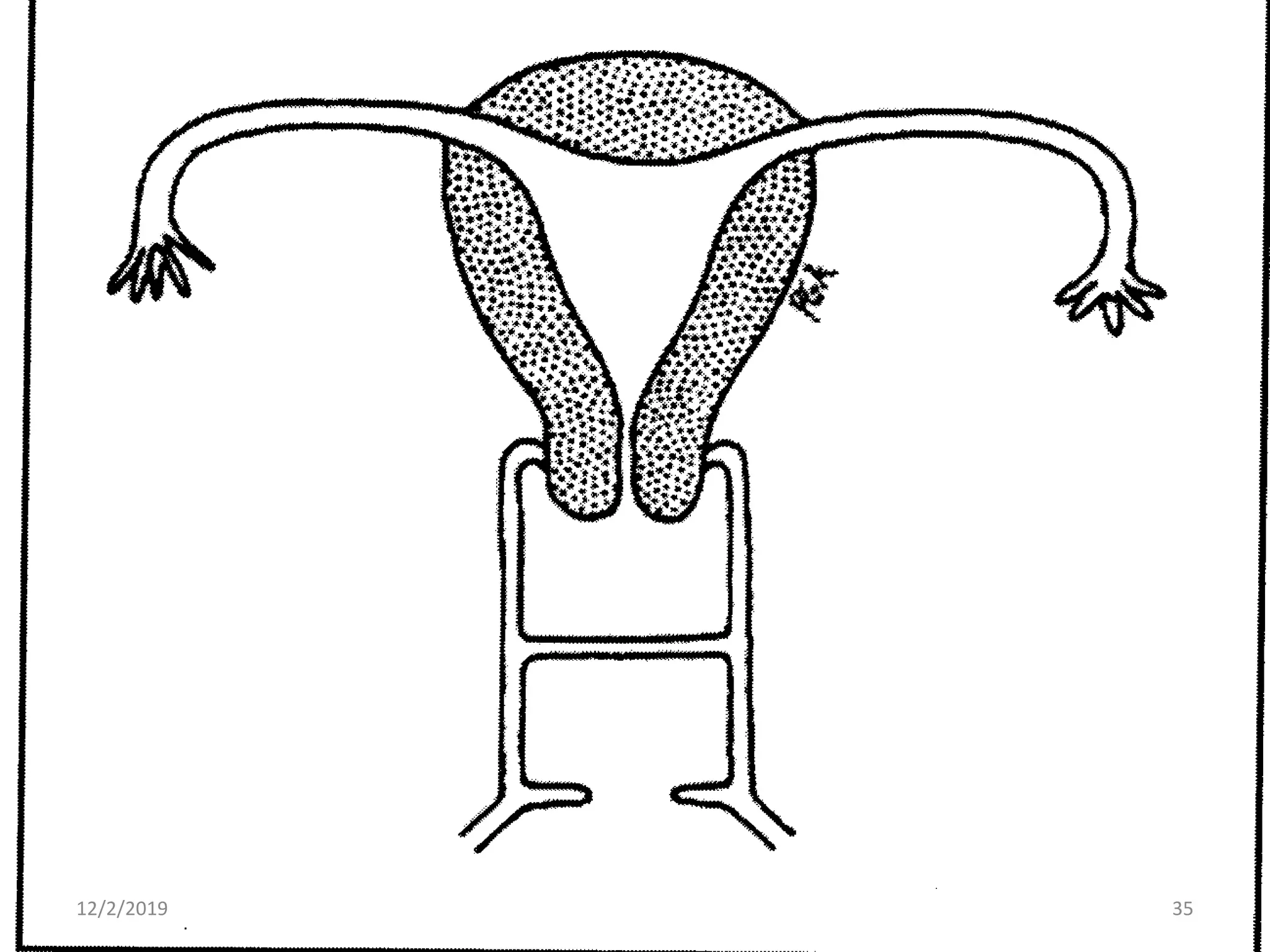 Female Genital Tract Ppt