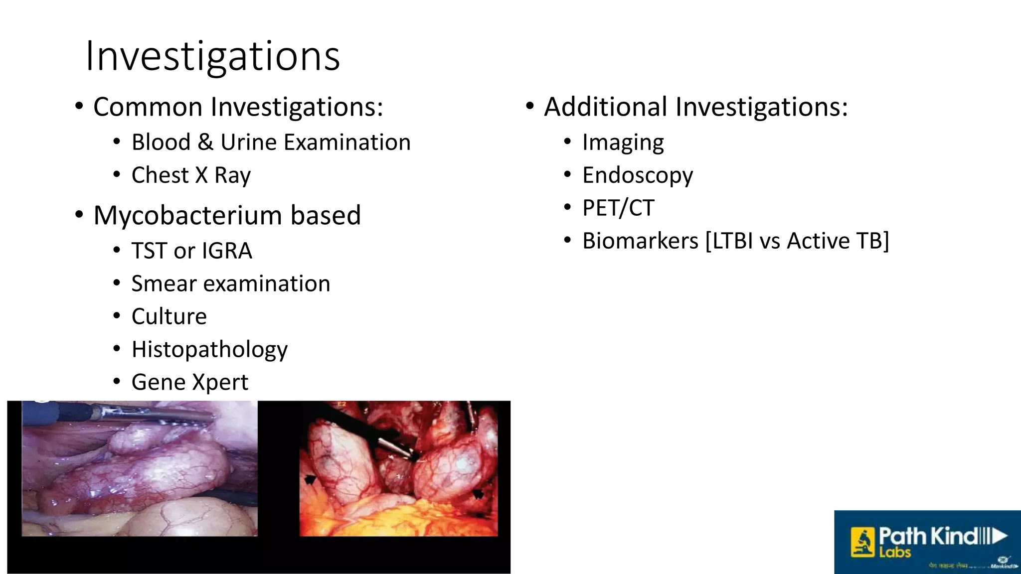Female genital tuberculosis | PPTX