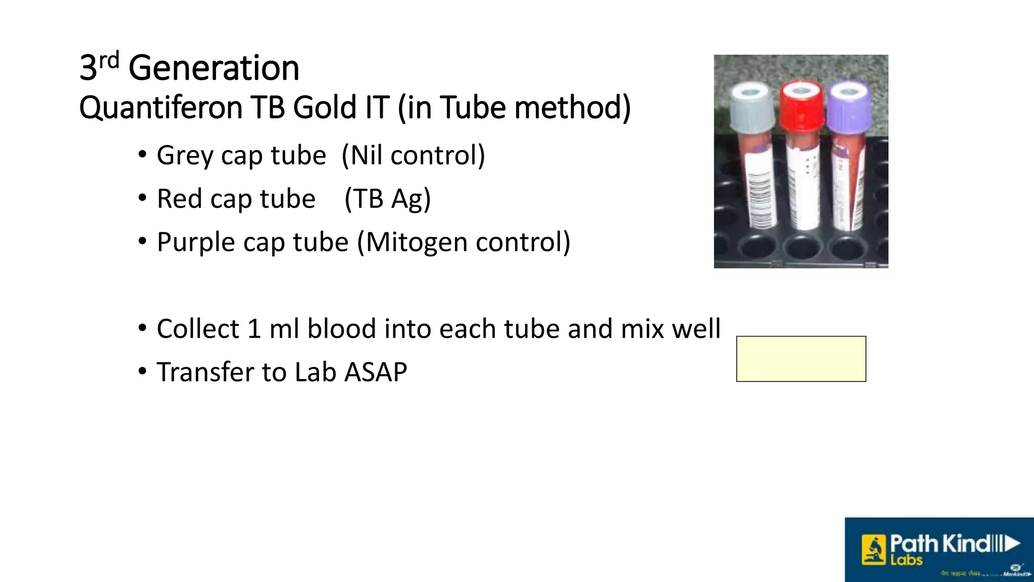 Female genital tuberculosis | PPTX