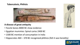 Female genital tuberculosis | PPTX