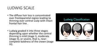 Female hair transplant | PPT