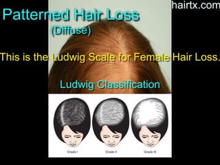 Dallas Female Hair Loss & Hair Restoration Principles by Dr. Sam Lam | PPTX