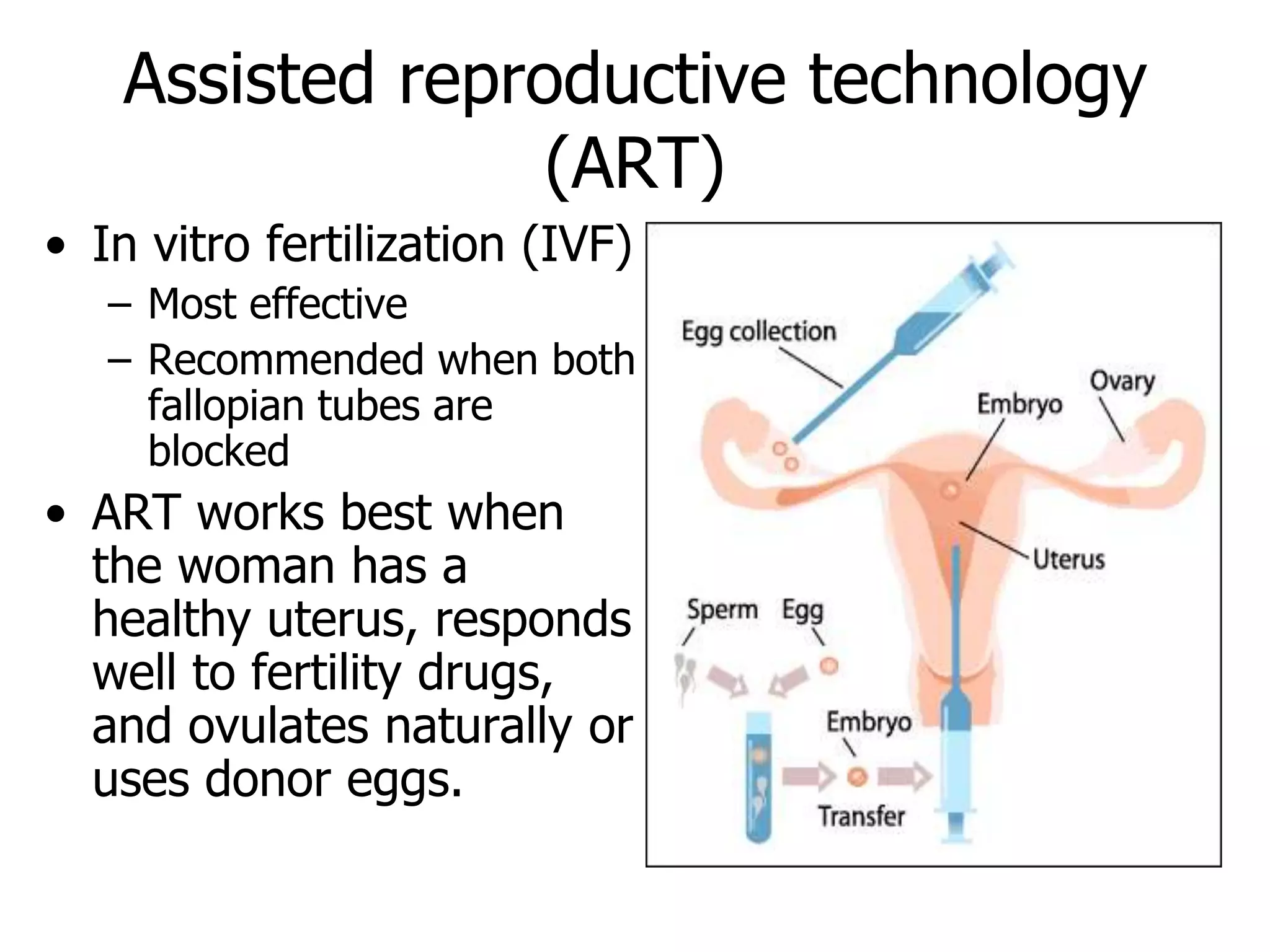 Female infertility | PPTX