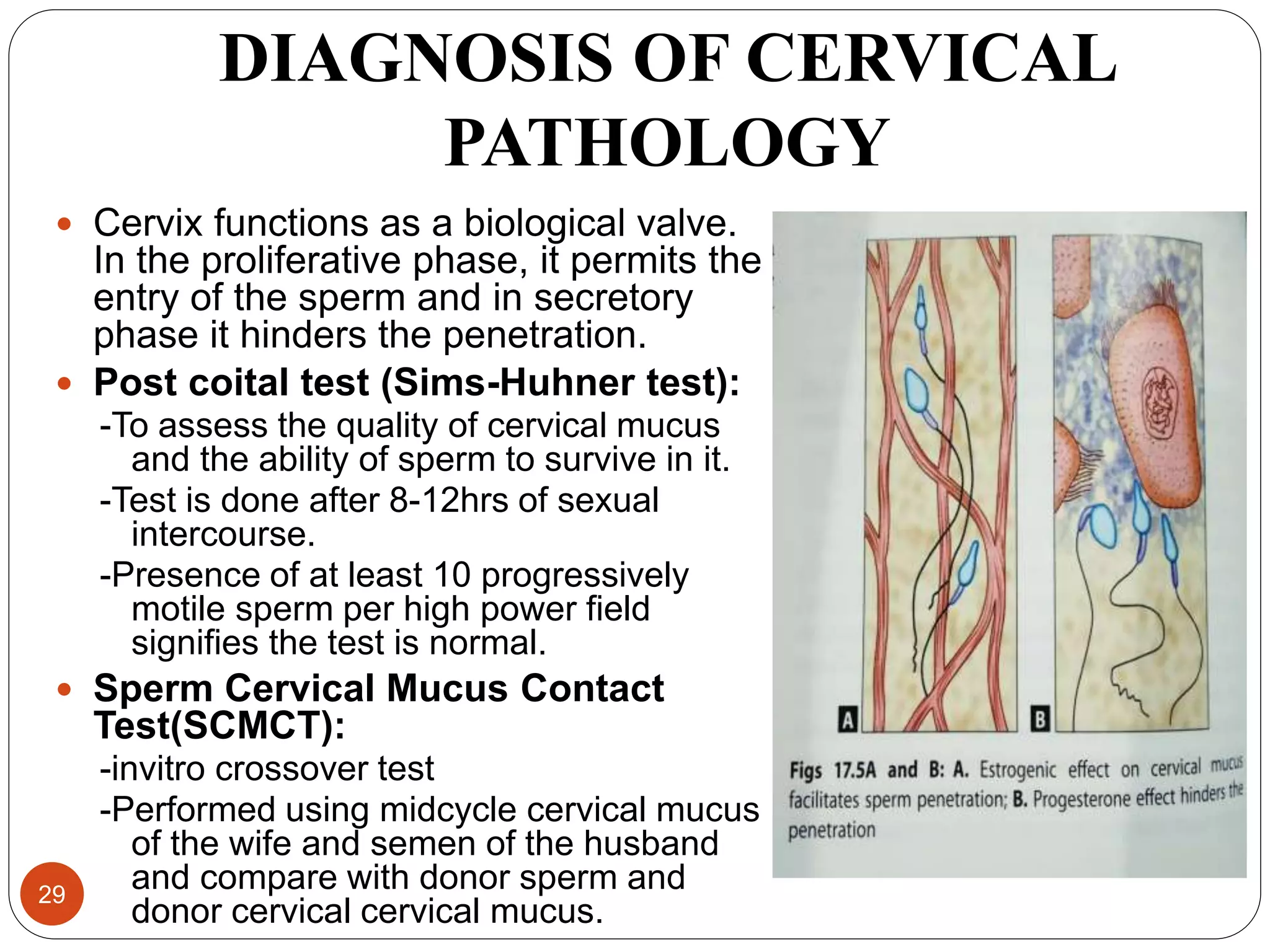 Female infertility | PPTX