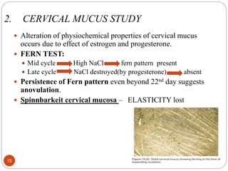 Female infertility | PPTX