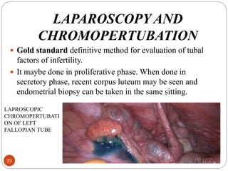 Female infertility | PPTX