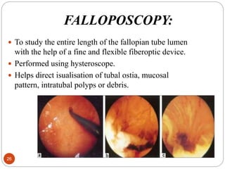 Female infertility | PPTX