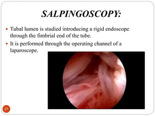 Female infertility | PPTX
