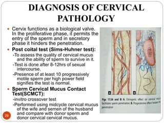 Female infertility | PPTX