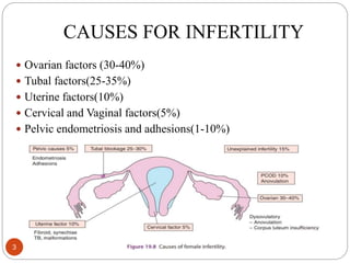 Female infertility | PPTX