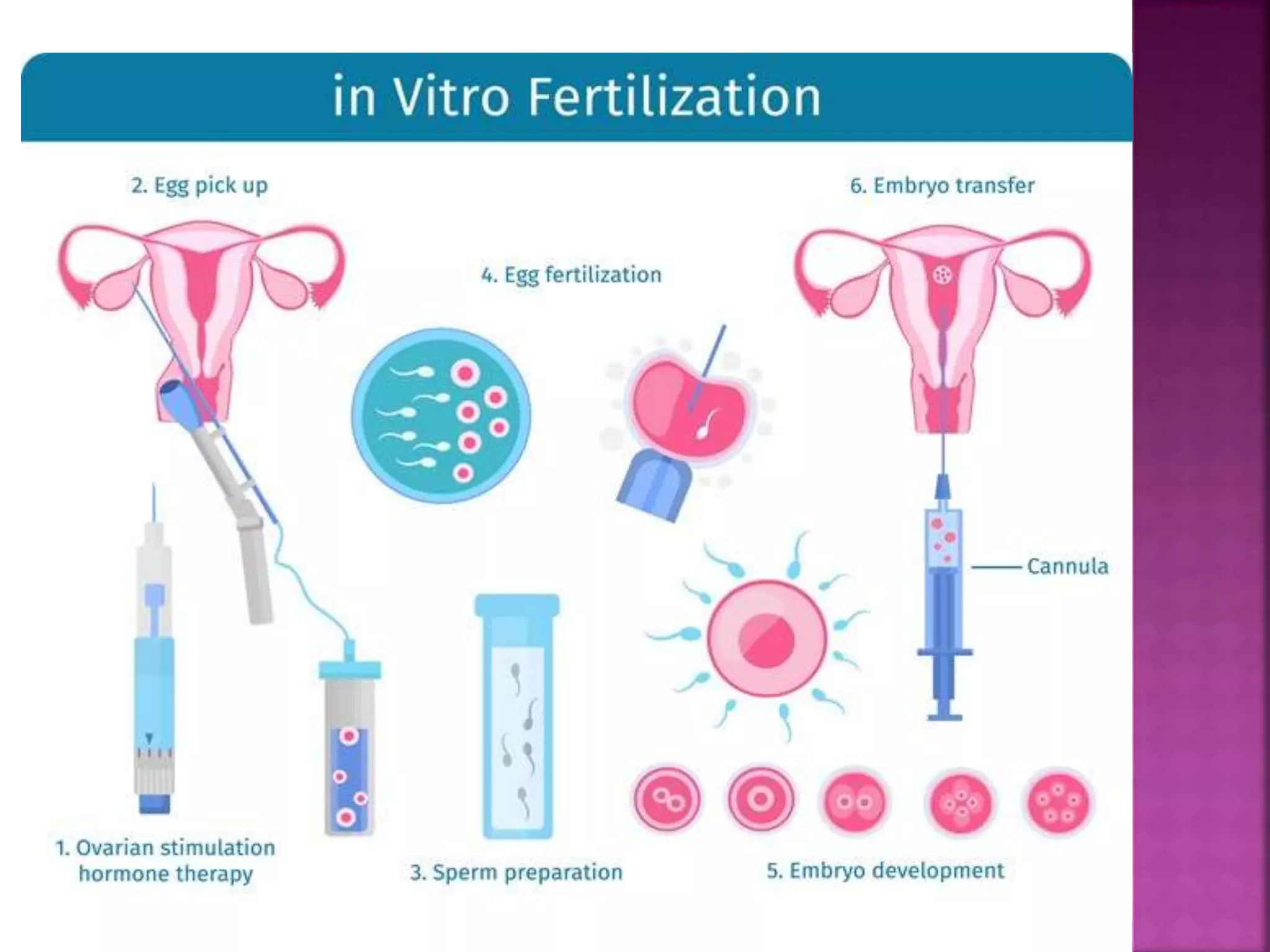Female infertility | PPTX