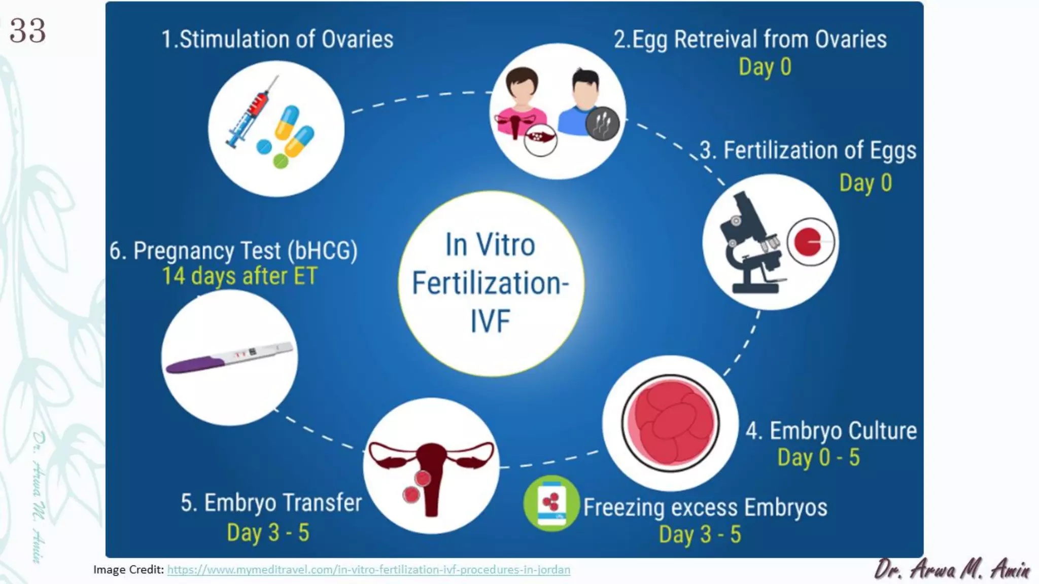 Female Infertility | PPT