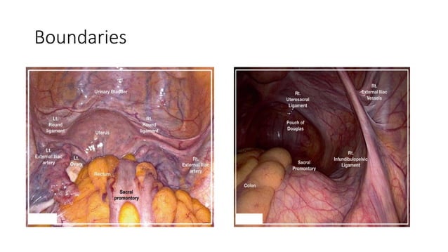 FEMALE PELVIC ANATOMY THROUGH A LAPAROSCOPIC EYE GM7.0 (1).pptx