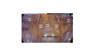 FEMALE PELVIC ANATOMY THROUGH A LAPAROSCOPIC EYE GM7.0 (1).pptx
