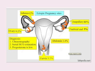 female reproductive organ disorders 1.pptx