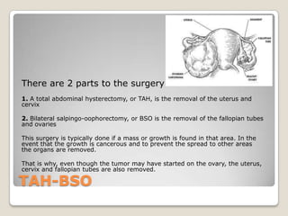 Female reproductive system | PPT