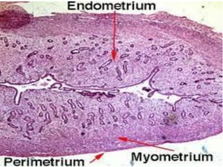 Uterus Slide Labeled