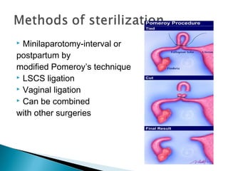 Female sterlization | PPT