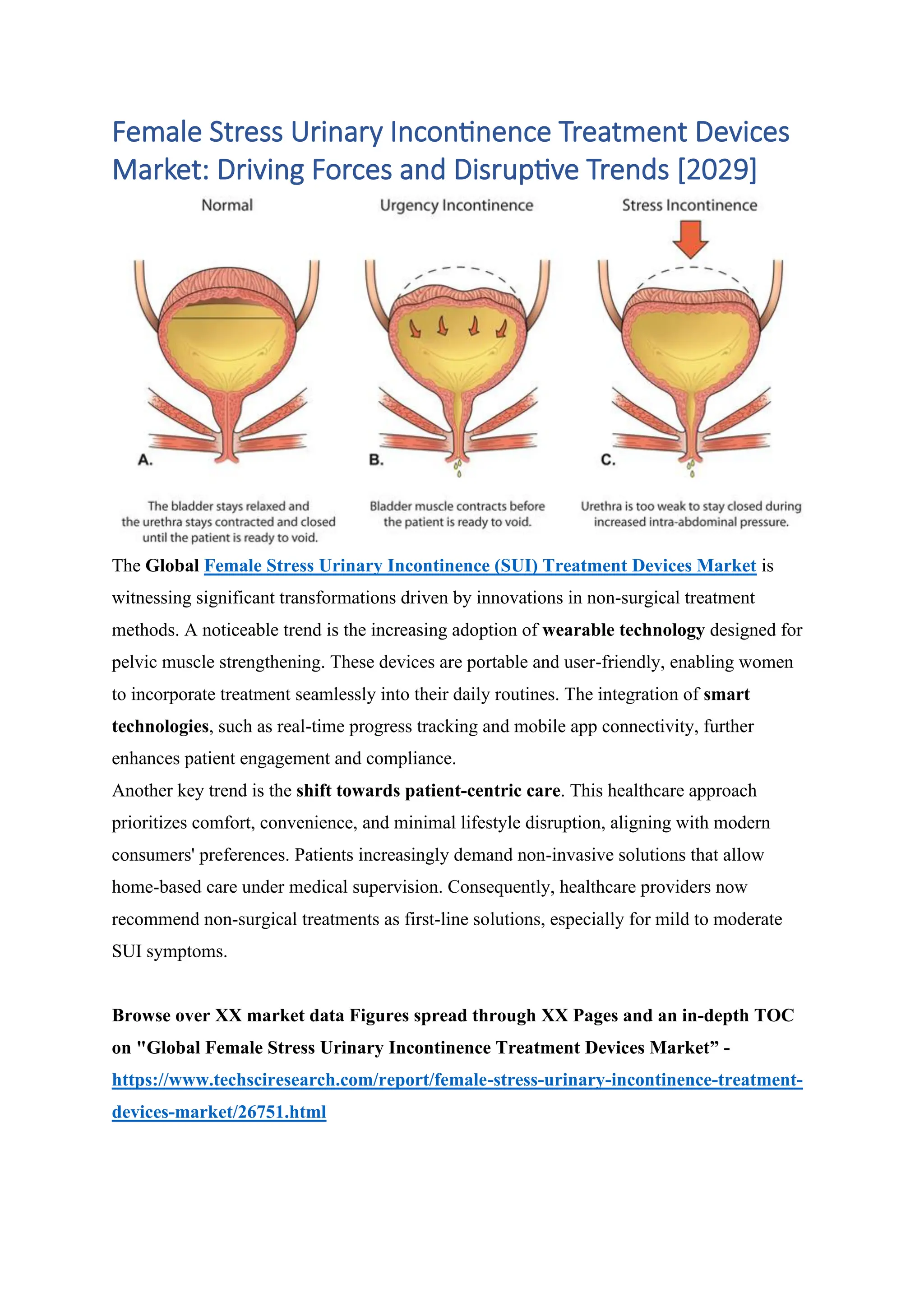 Female Stress Urinary Incontinence Treatment Devices Market | PDF
