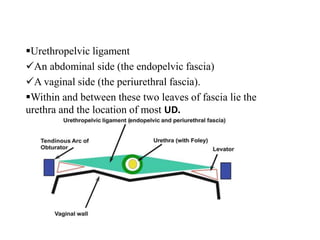 Female urethral diverticula | PPTX