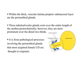 Female urethral diverticula | PPTX