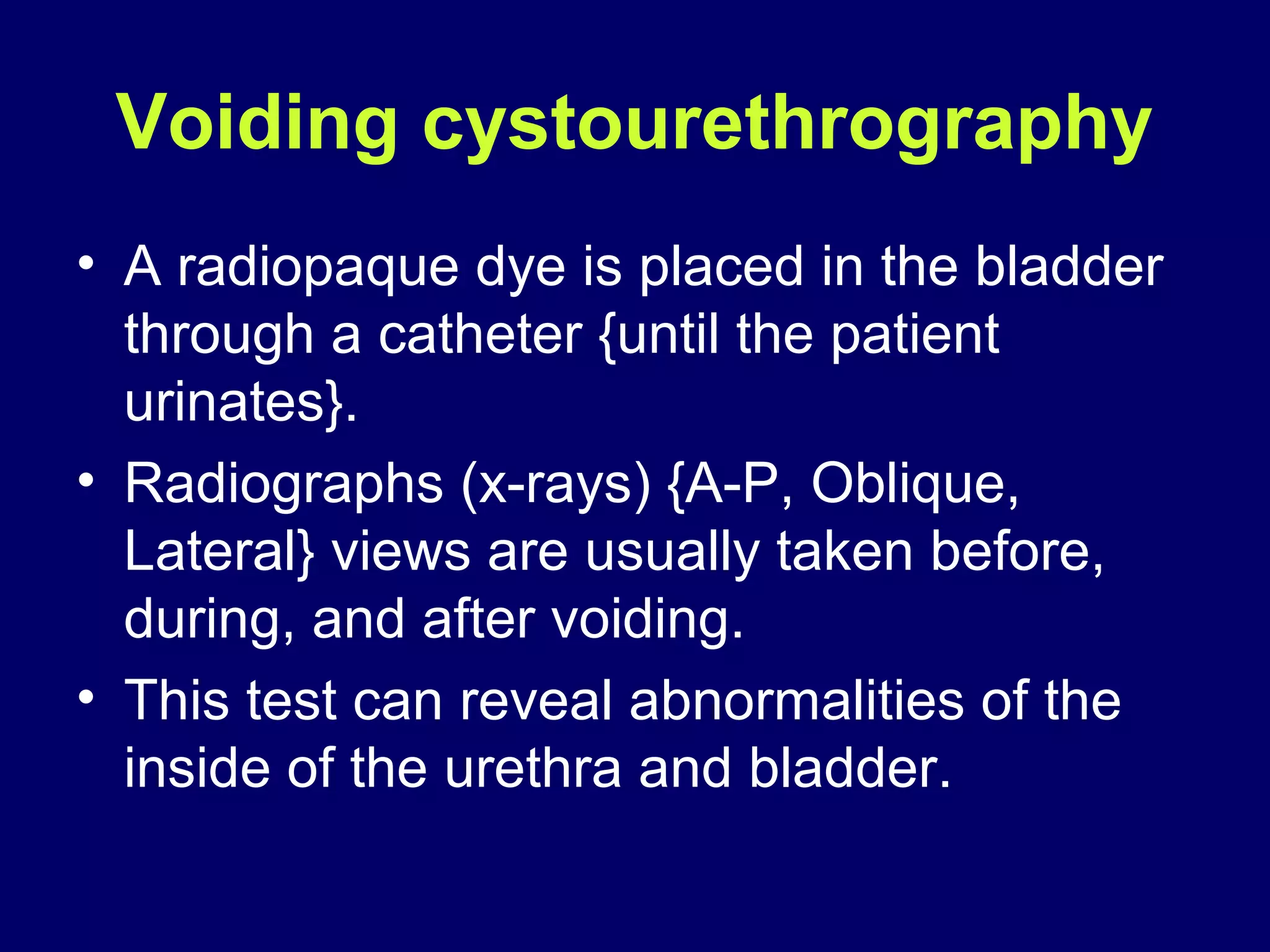 Female urinary incontinence | PPT
