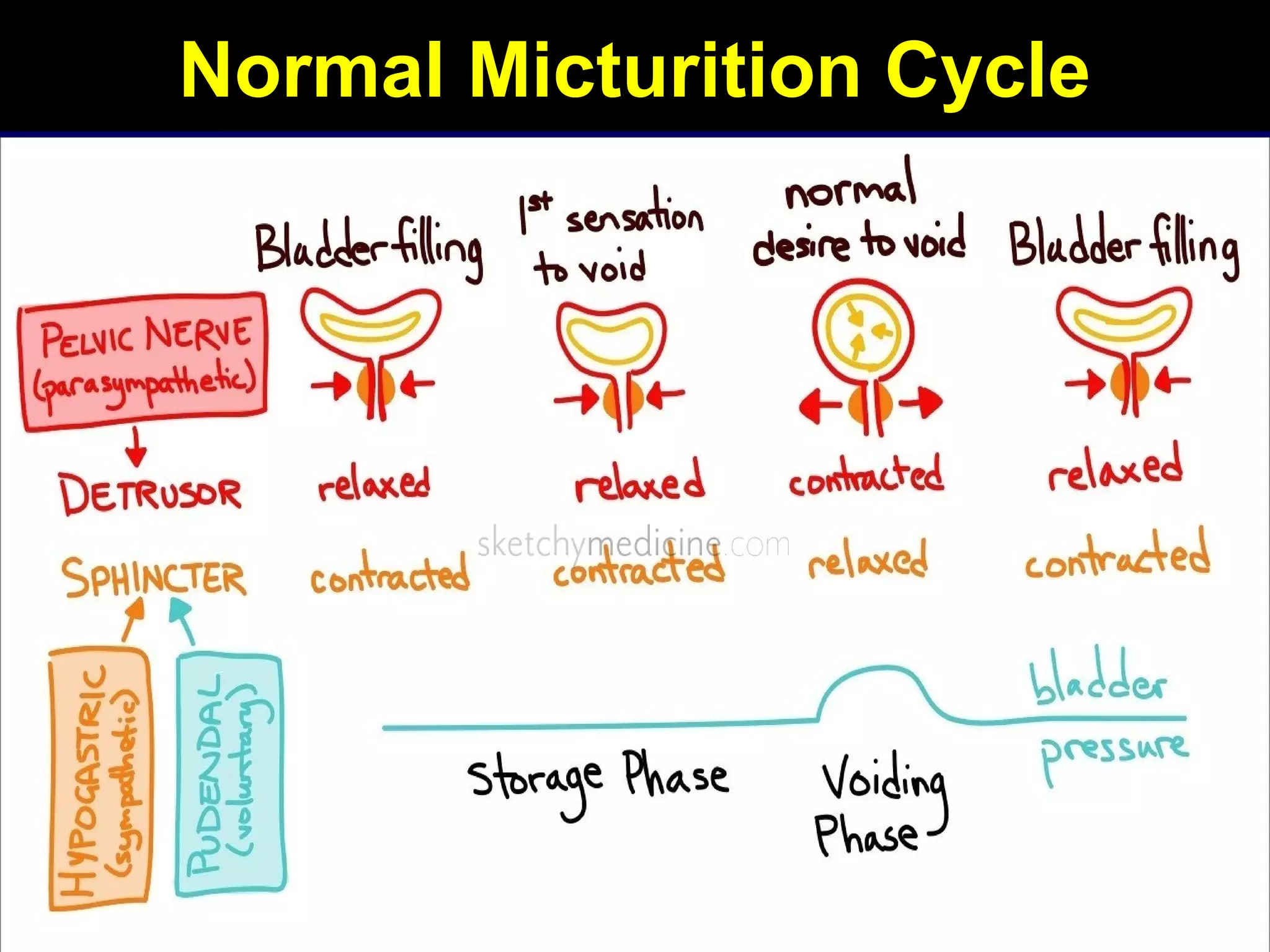 Female Urinary Incontinence Ppt