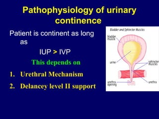 Female urinary incontinence | PPT