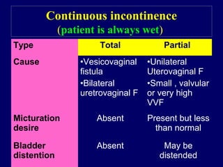 Female urinary incontinence | PPT