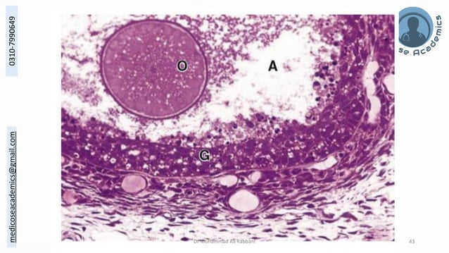 Femal Reproductive System - Ovary - Uterus - Dr Muhammad Ali Rabbani - Medicose Academics | PDF