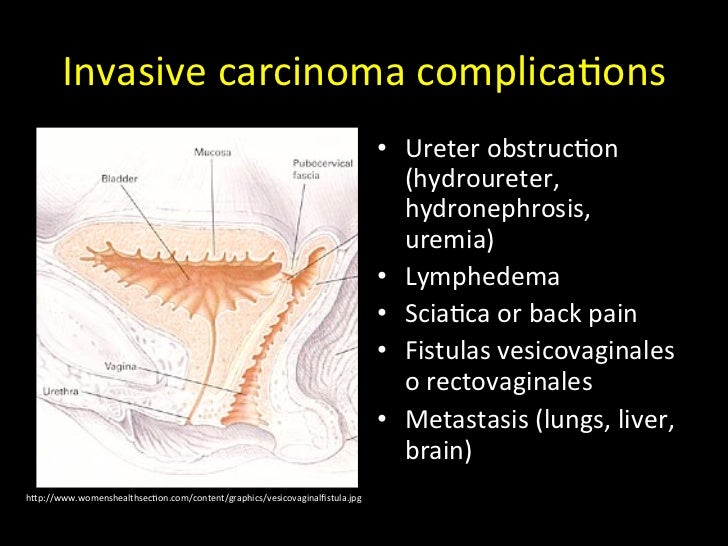 Female Genital Tract (1)