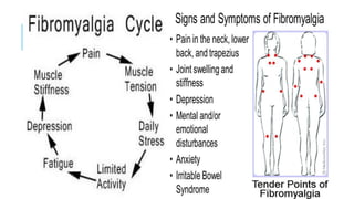 Fibromyalgia | PPTX | Physical Therapy | Wellness