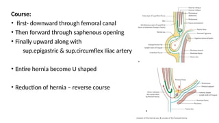 femoral hernia anatomy presentation.pptx